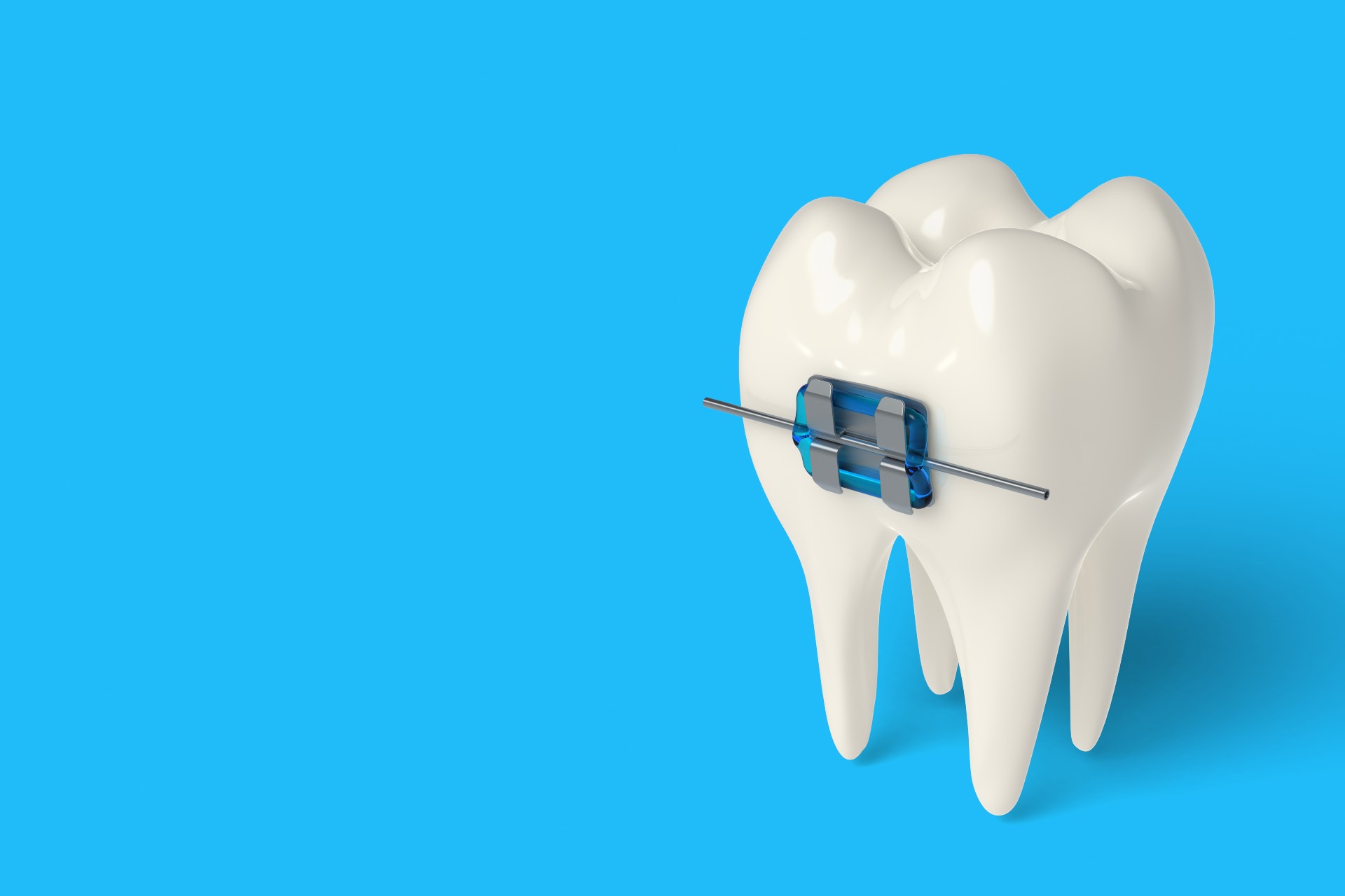 Learn about the different braces types that exist